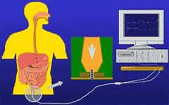 Manometria anorrectal - Proctología